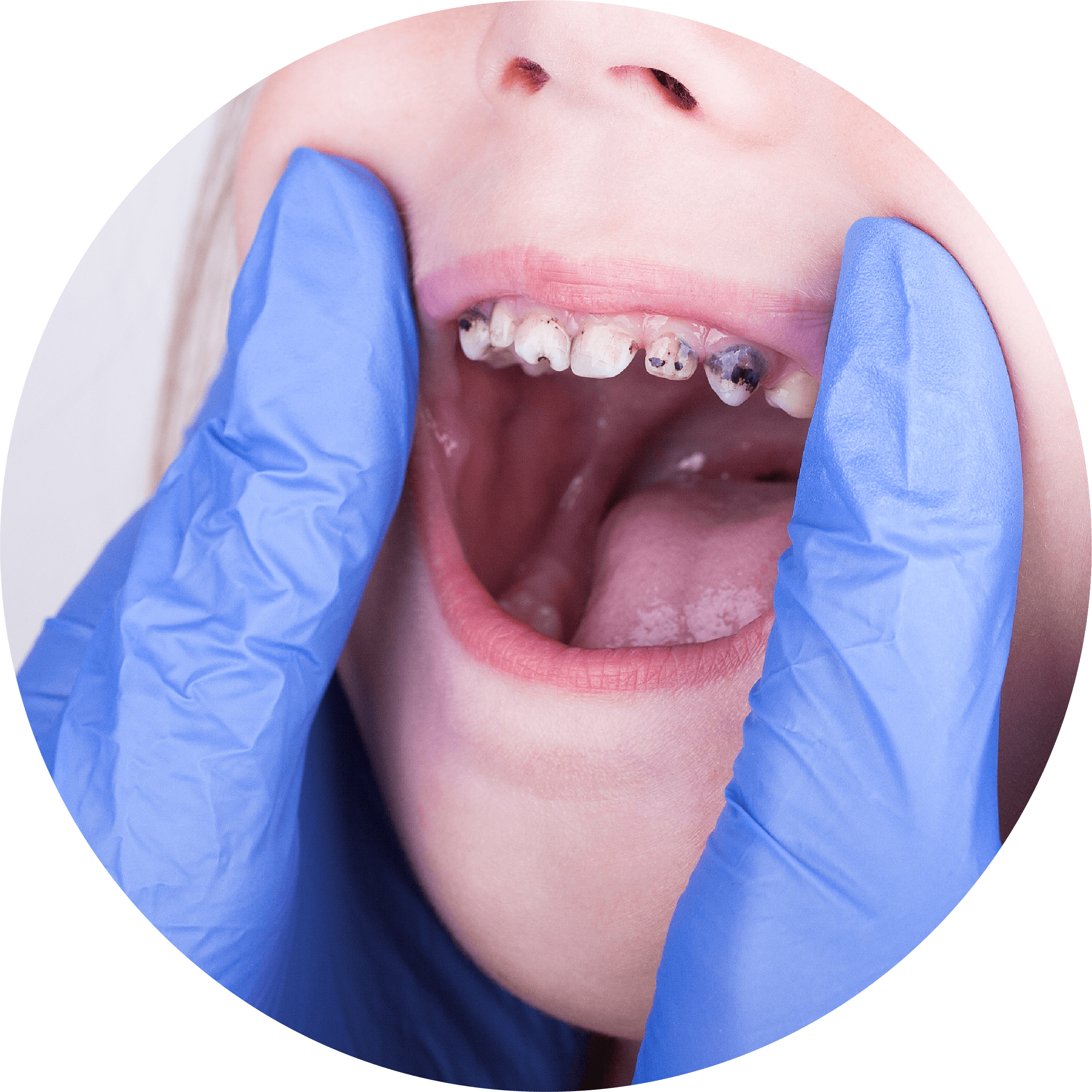 America s ToothFairy 5 Reasons For The Oral Health Crisis In America america-s-toothfairy-5-reasons-for-the-oral-health-crisis-in-america